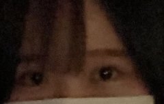 눈 어땜 | 네이트 판